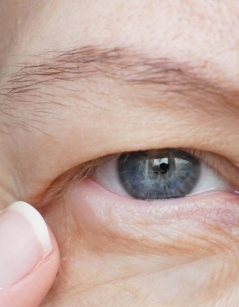 Droopy Eyebrows: Causes and Treatment | HR Plastic Surgery